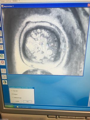 Cerec Inlab Compact Milling Unit | InEos Scanner |PC w/Inlab v3.83 ...